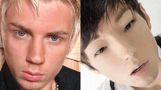 Braziliani bëhet “aziatik”, përmes operacionit plastik - Telegrafi ...