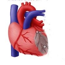 The gene responsible for heart attacks is discovered - Telegraph ...