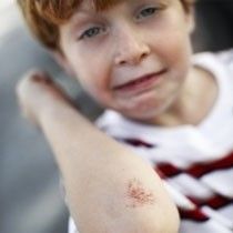 The four-year-old survives the 30-meter fall - Telegrafi - Telegrafi