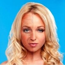 This is what the skin would look like without protection - Telegrafi ...