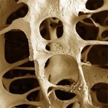 Pesha trupore dhe osteoporoza - Telegrafi - Telegrafi