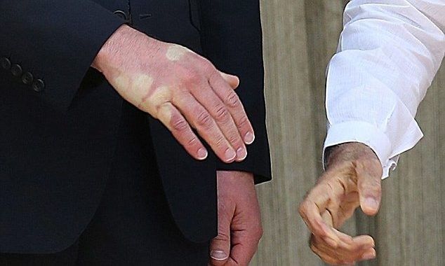 The squeeze by the leader who left marks on the Prince's hand (Photo ...