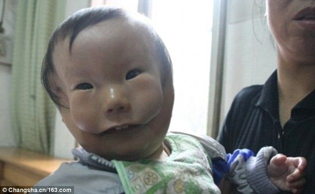 The touching story of the "boy with a mask": He seems to have two faces ...