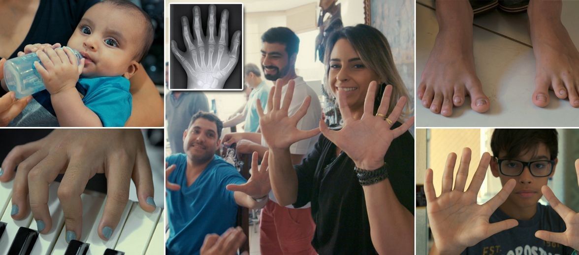 The family of 14 members who have six fingers each welcome the youngest ...