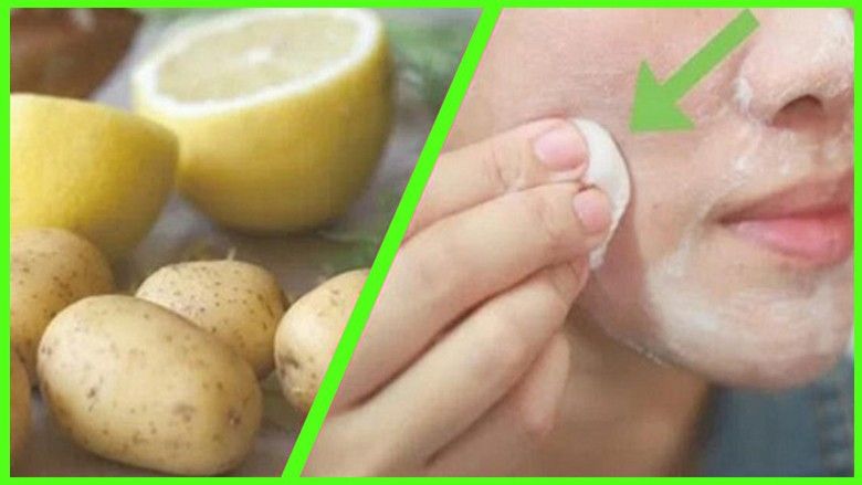 Potato skin + lemon juice and goodbye brown spots, marks and pimples ...