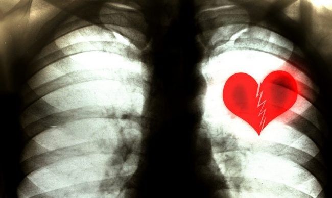 Cardiologist explains: You really can die of a broken heart - Telegraph ...