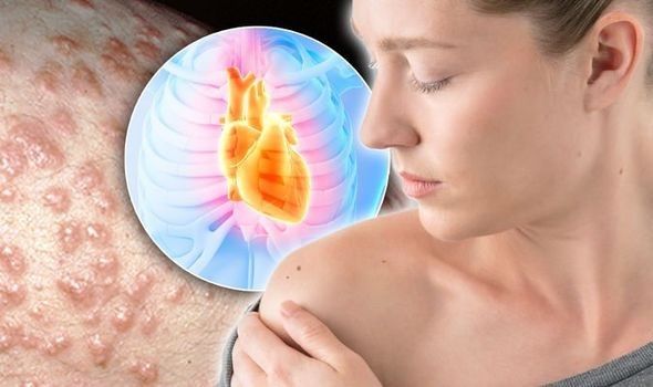 Some changes in the skin can be warning signs of a heart attack ...
