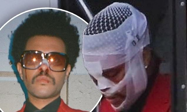 The Weeknd appears swollen and with a bandaged head in the filming of ...