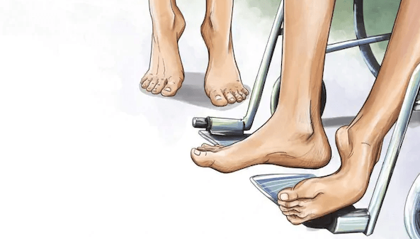 Rare diseases - mostly related to genetics - affect 5 million people in ...