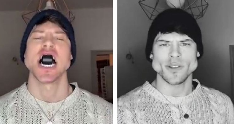 The boy did exercises for his jaw and showed a dramatic transformation ...