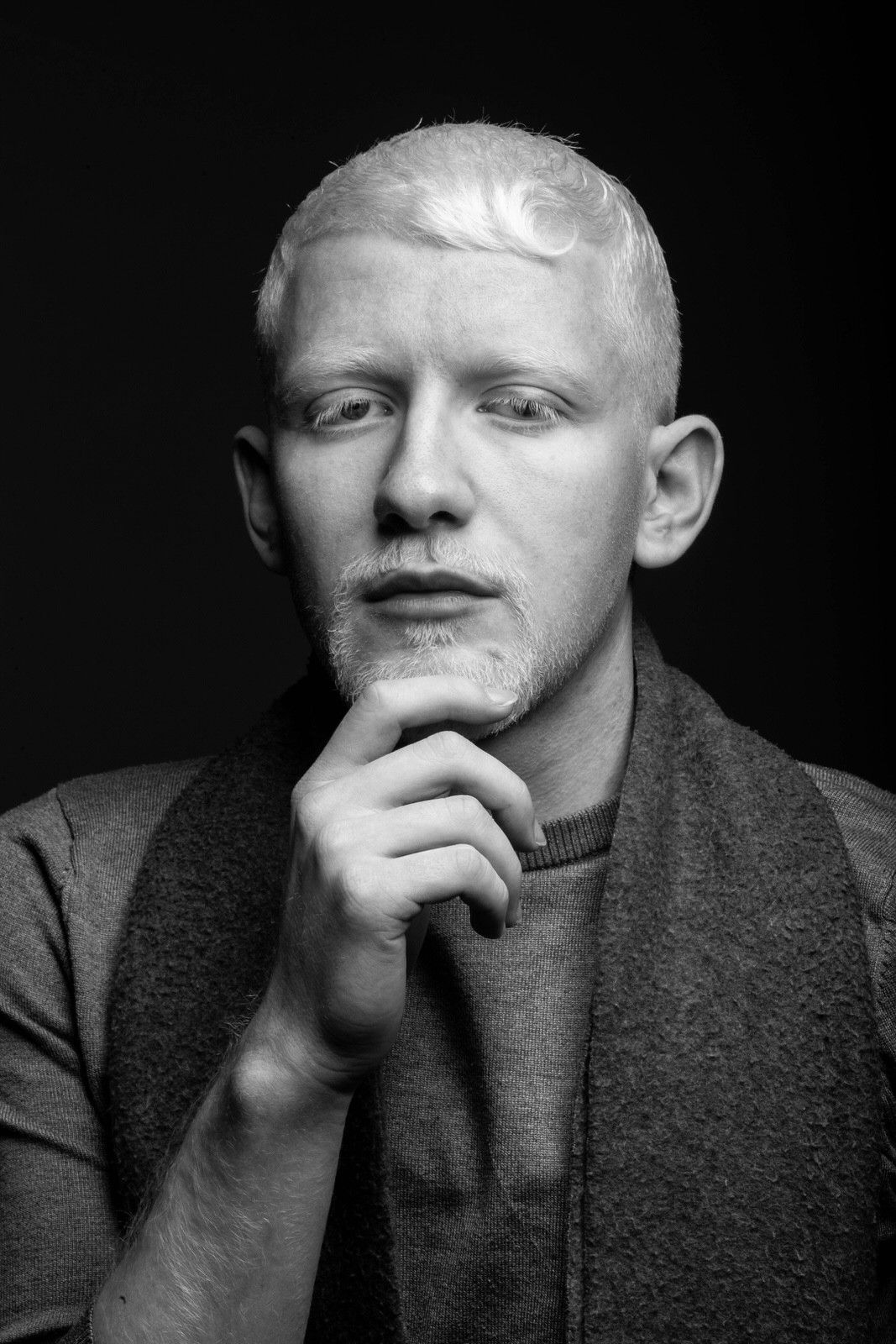 The albino Albanian model that attracted the attention of Vogue Italia ...