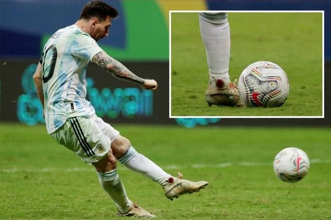 Messi, despite bleeding on his feet, managed to finish a vital match ...