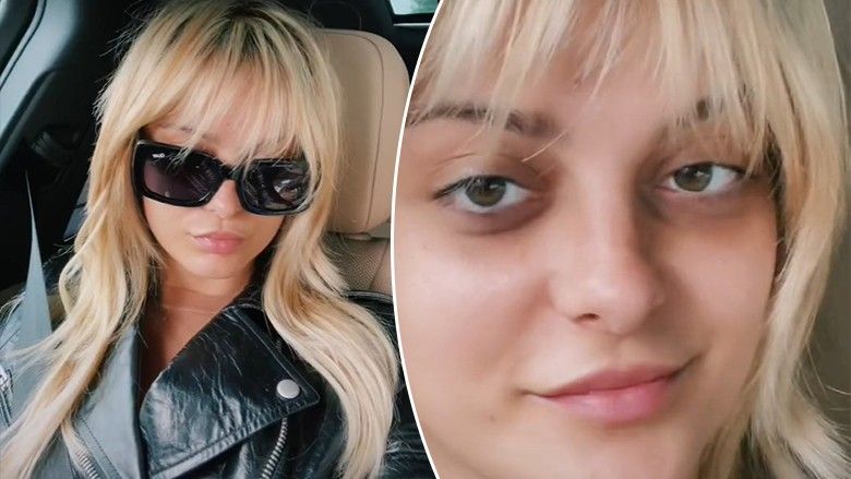 Kritikohet për rrathët e zinj rreth syve, Bebe Rexha: Nuk më pengojnë ...