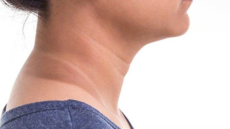 Symptoms of insulin resistance can be seen on the skin of the neck, pay ...
