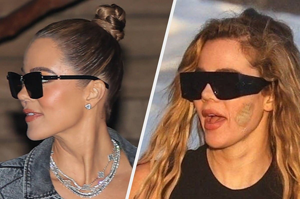 She was seen with a bandage on her face - Khloe Kardashian reveals that ...