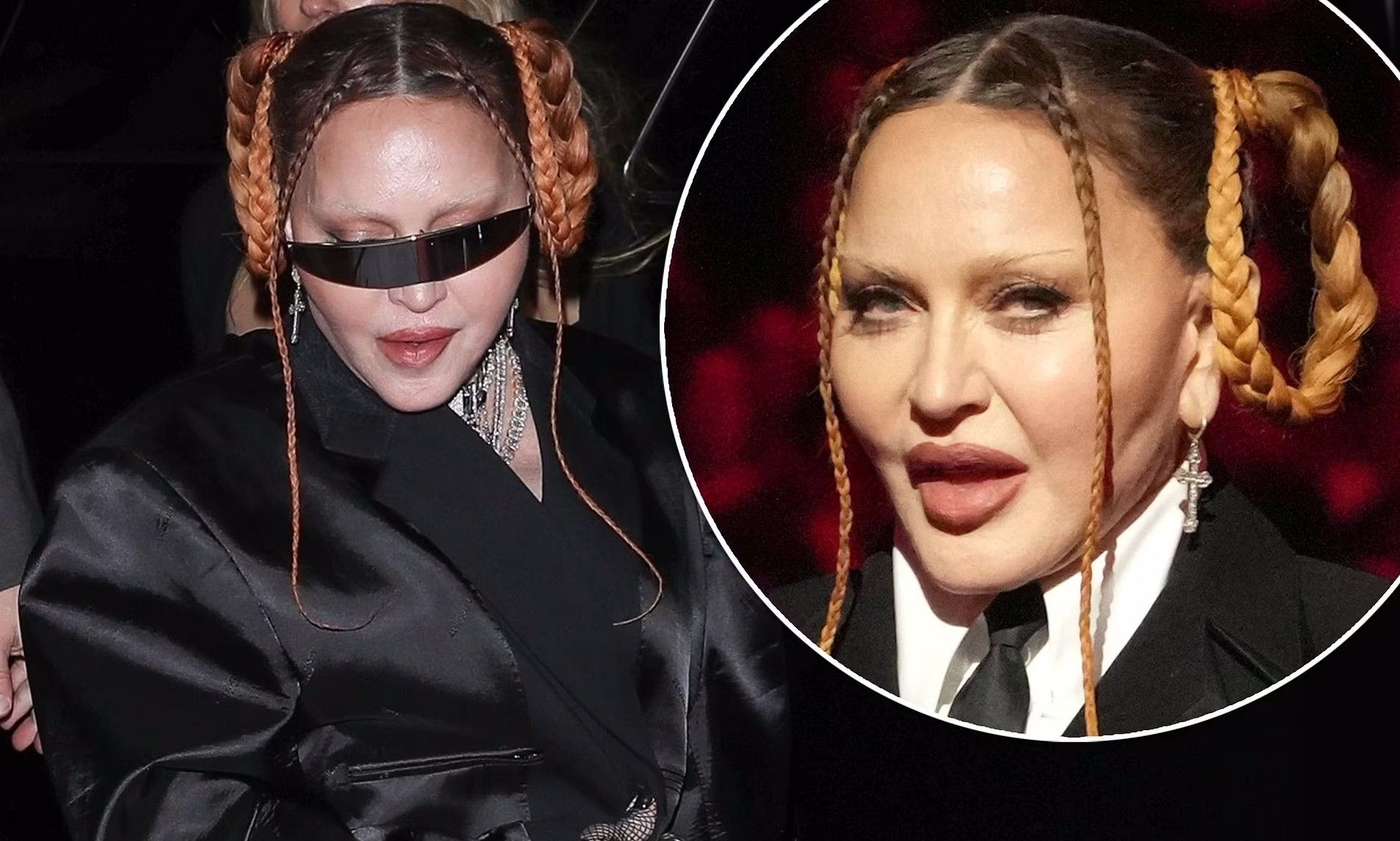 Madonna finally admits that she has had plastic surgery on her face ...