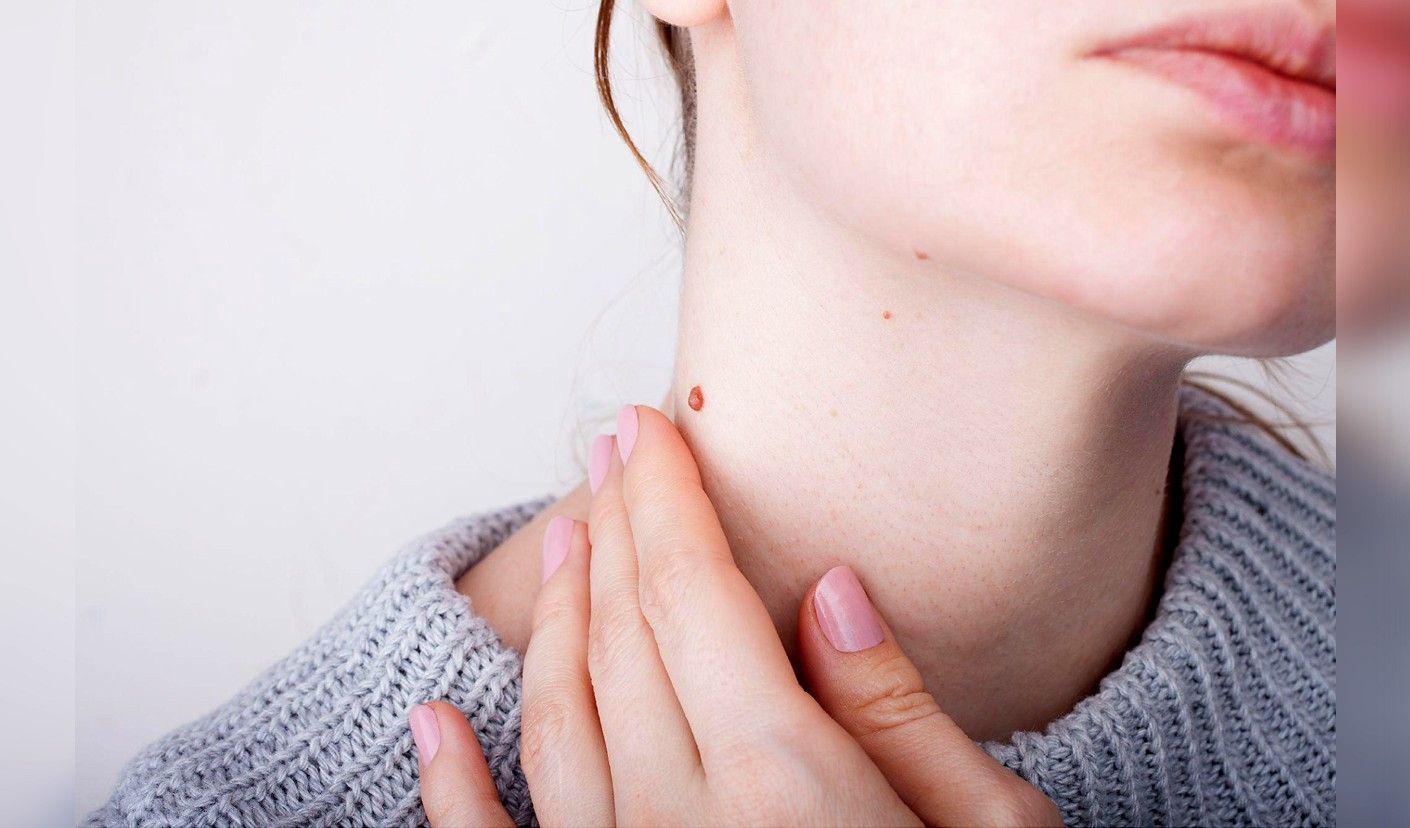 Keni më shumë se 10 lytha në trup? Ja përse duhet të jeni të lumtur ...