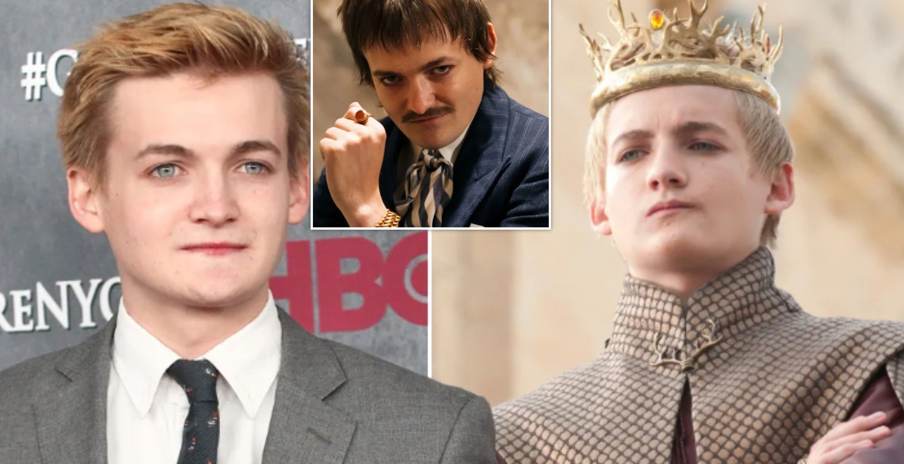 The star of "Game of Thrones", Jack Gleeson returns after several years ...