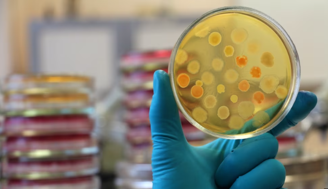 Ethet hemorragjike në Maqedoninë e Veriut - thirrje për kujdes të ...