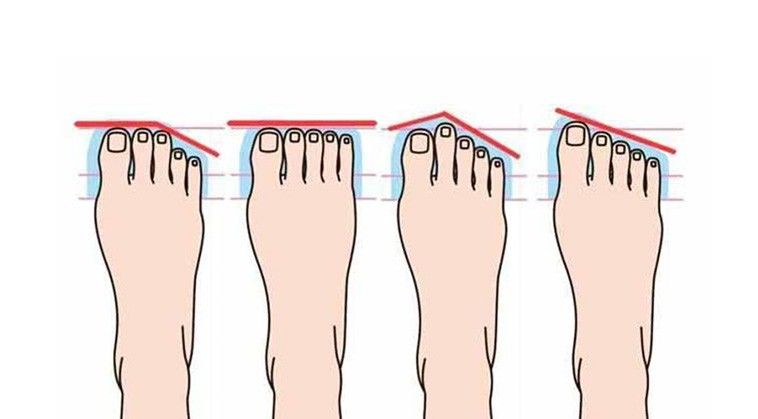 What your feet are, so is your heart: The shape of the feet reveals the ...