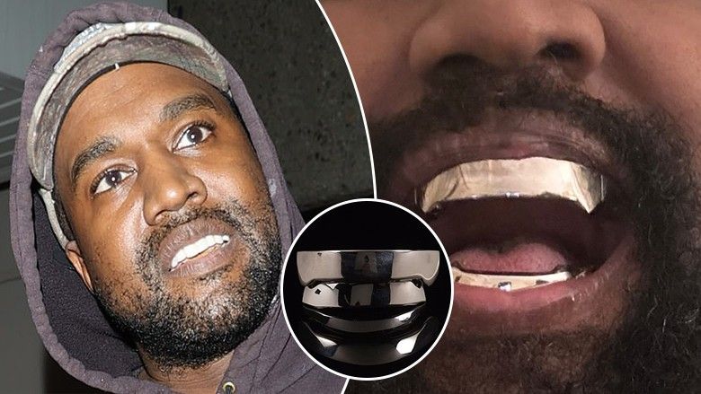 Kanye West removes all his teeth and replaces them with titanium ...