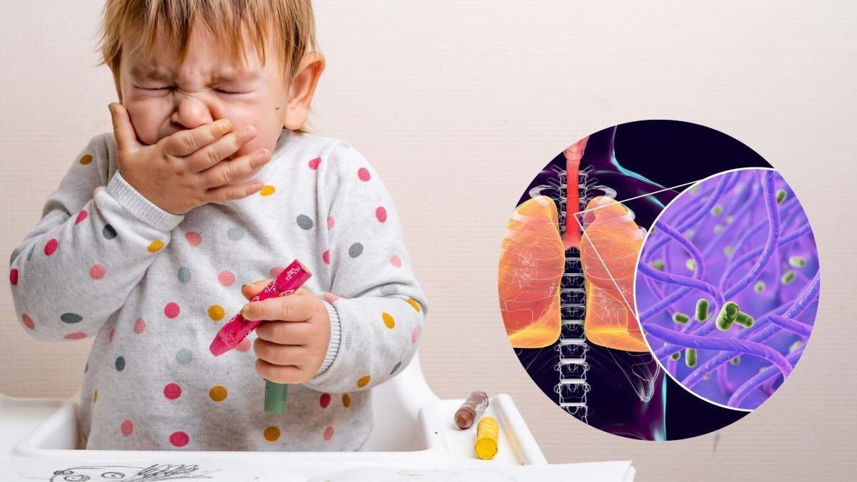 Të gjitha përgjigjet për pyetjet që lidhen me pertusis ose kollën e ...