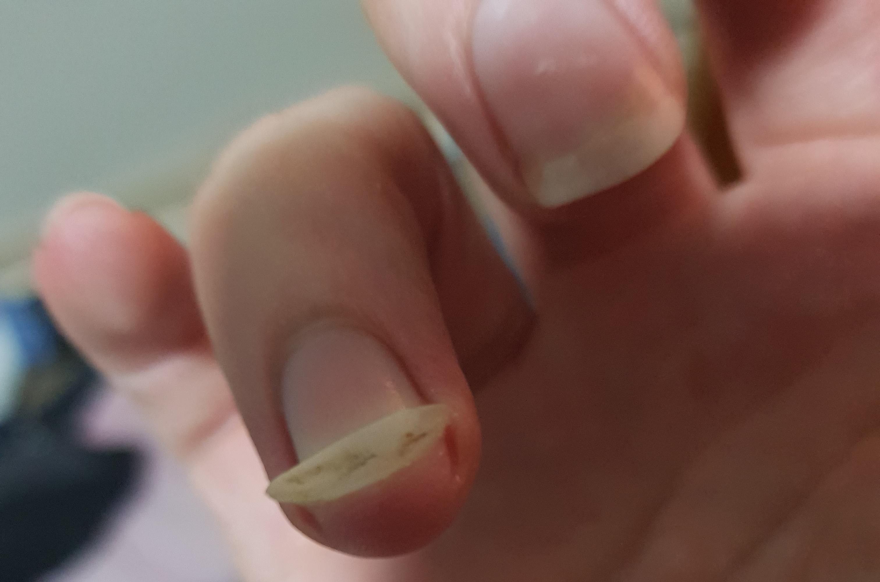 Warning: If you notice these differences on your nails, you may be in ...