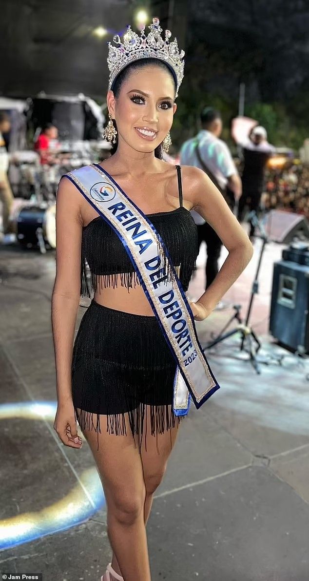 The well-known model from Venezuela dies after surgery on the jaw and ...