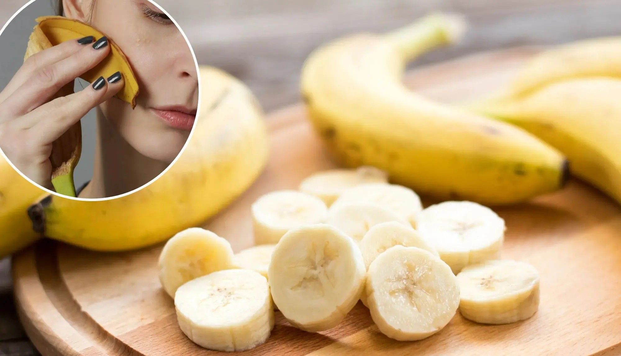 Lëvore bananeje për lythat: Zgjidhje e thjeshtë për problemin e ...