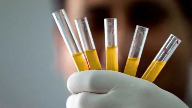 What is golden blood? The rarest blood type, only 43 people in the ...