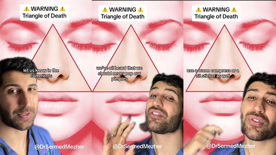 What you need to know about the "triangle of death" on the face and why you should not 'touch ...