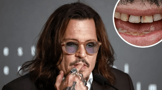 Finally: Johnny Depp gets his teeth fixed - The Telegraph - The Telegraph