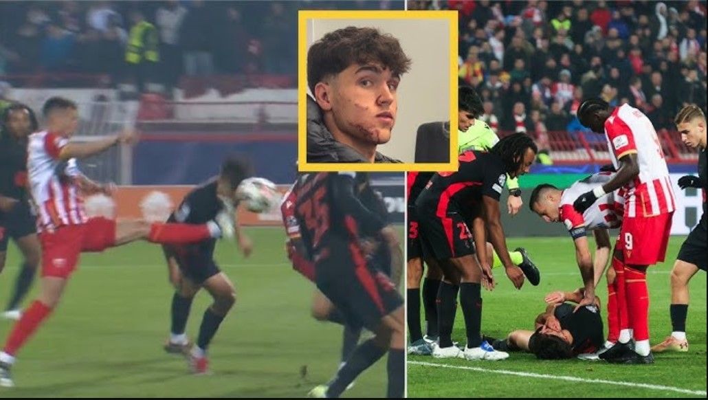 An absolute fighter, Cubarsi ended up with 10 stitches in his face ...