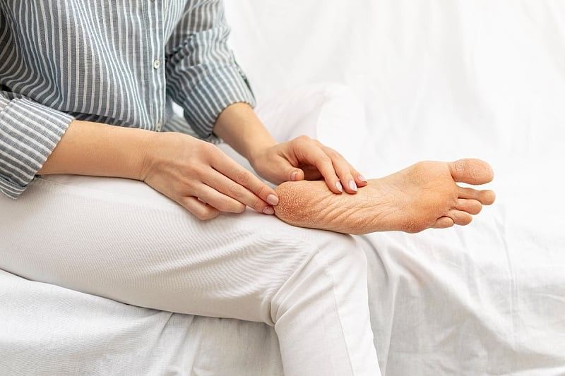 How to get rid of cracked heels, tips for smooth and cured feet ...