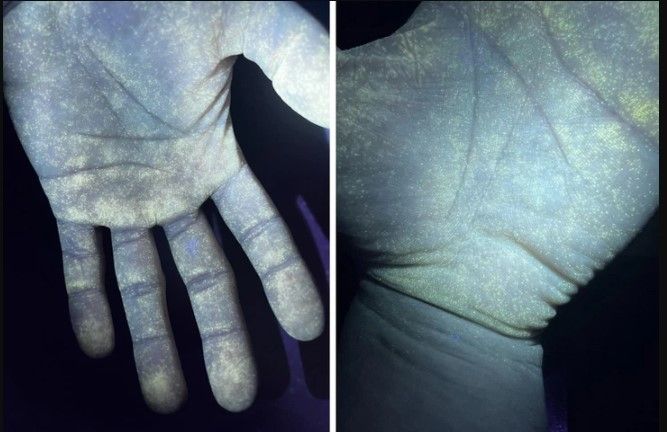 Unusual features of the human body that make their "owners" unique ...