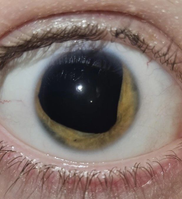 Unusual features of the human body that make their "owners" unique ...