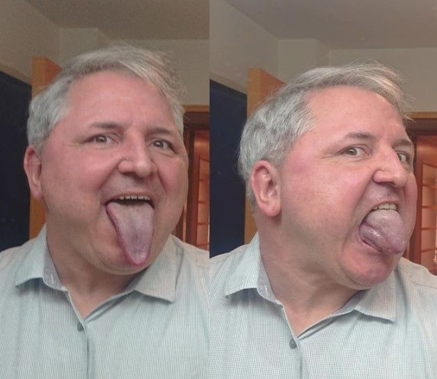 Unusual features of the human body that make their "owners" unique ...