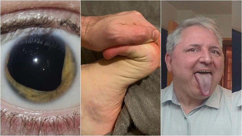 Unusual features of the human body that make their "owners" unique ...