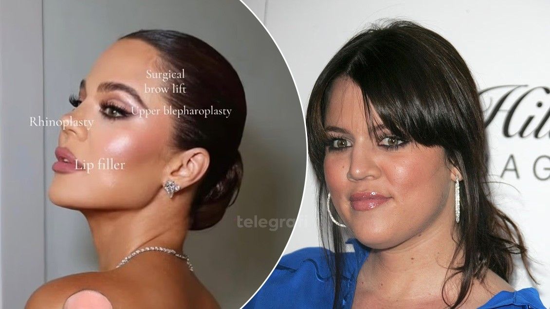 Khloe Kardashian faces speculation: Reveals all the interventions she ...